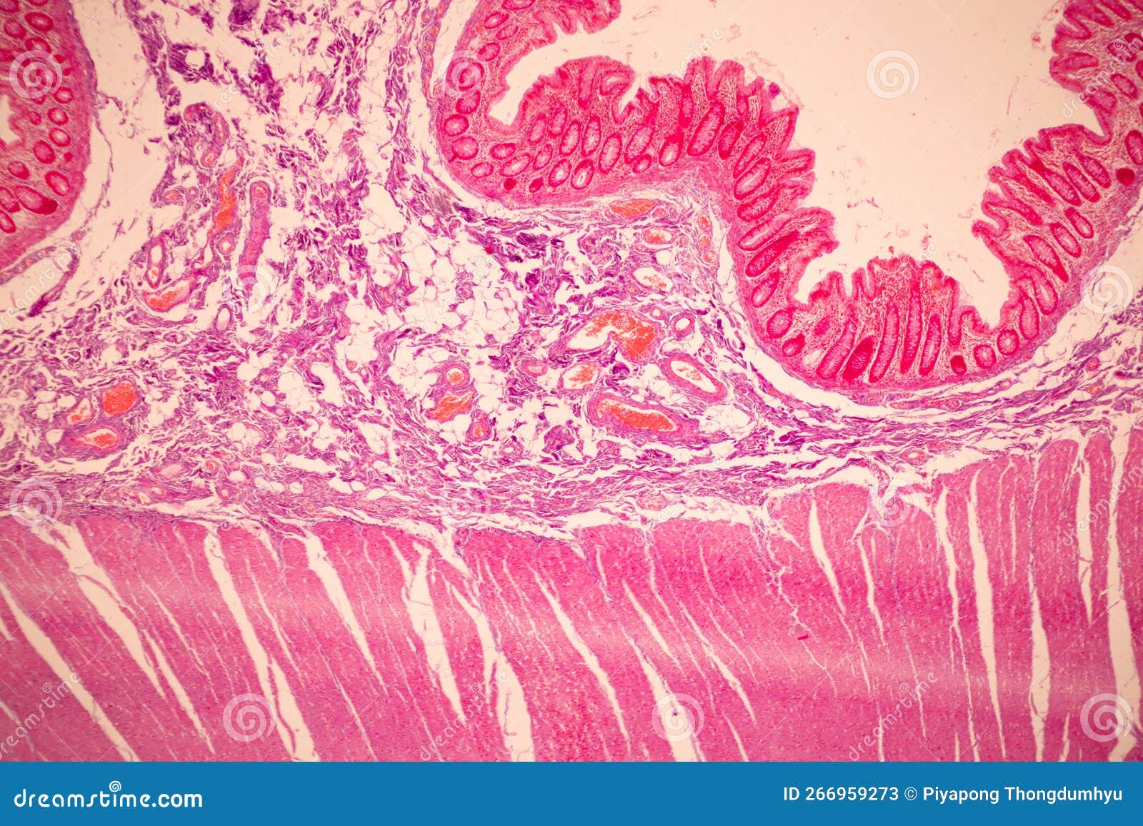 Tissue of Small Intestine Duodenum, Large Intestine Human and Stomach ...