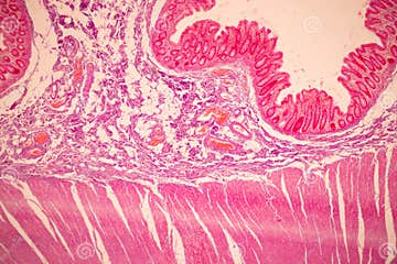 Tissue of Small Intestine Duodenum, Large Intestine Human and Stomach ...