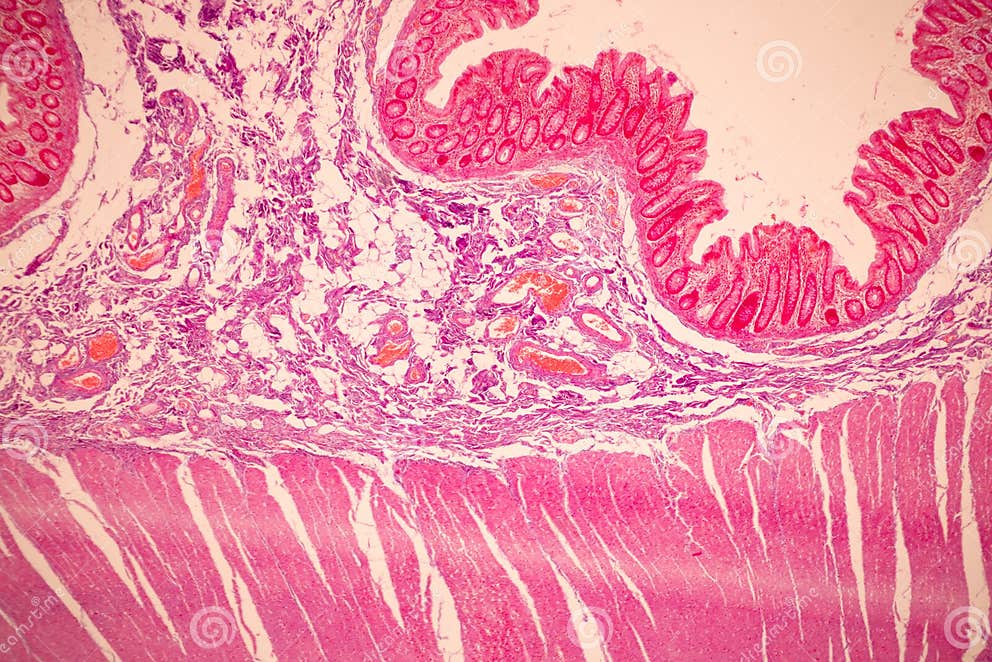 Tissue of Small Intestine Duodenum, Large Intestine Human and Stomach ...