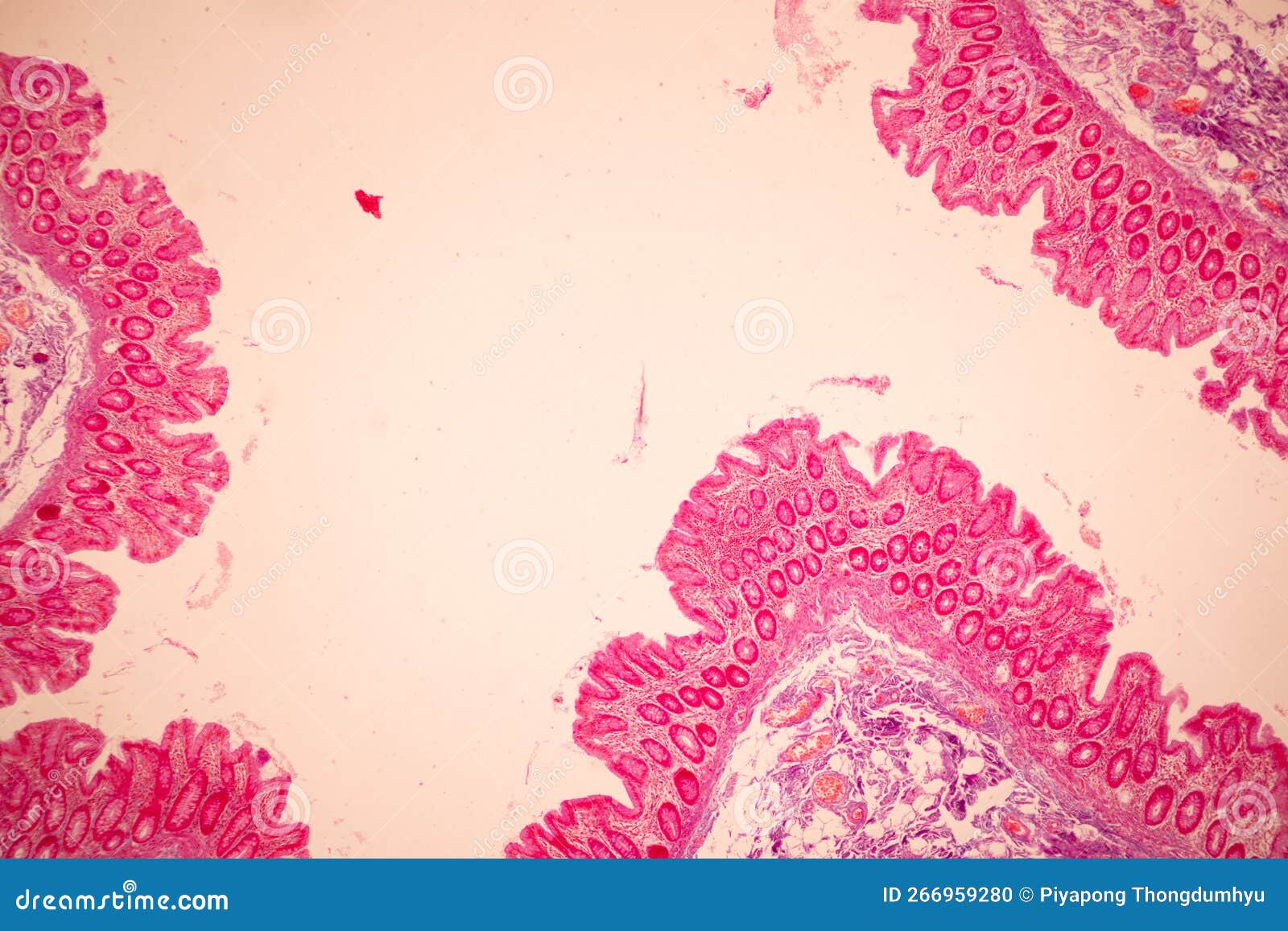 Tissue of Small Intestine Duodenum, Large Intestine Human and Stomach ...