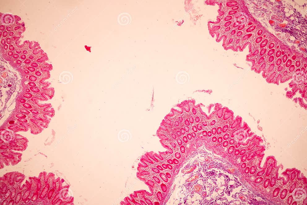 Tissue of Small Intestine Duodenum, Large Intestine Human and Stomach ...