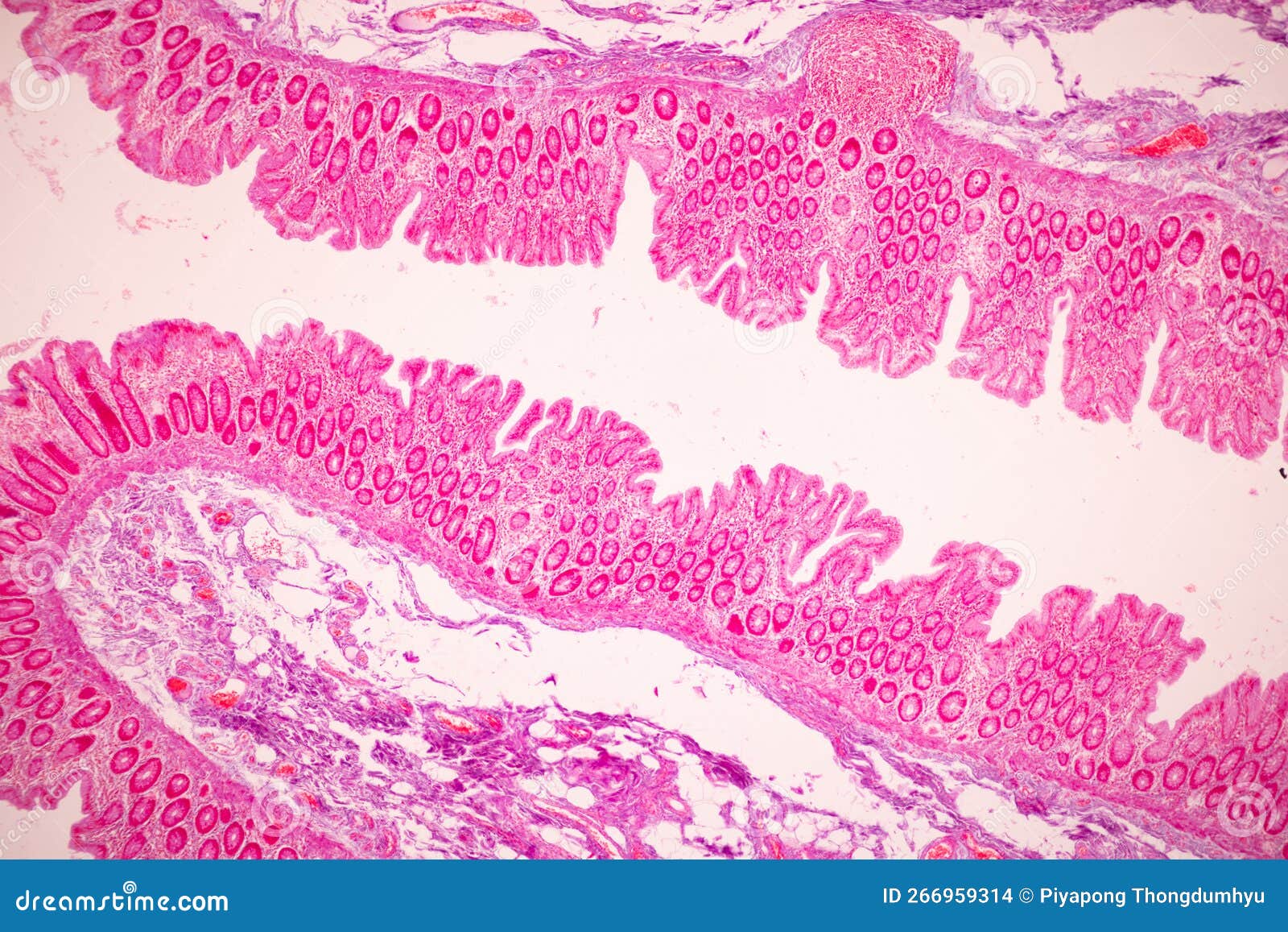 Tissue of Small Intestine Duodenum, Large Intestine Human and Stomach ...