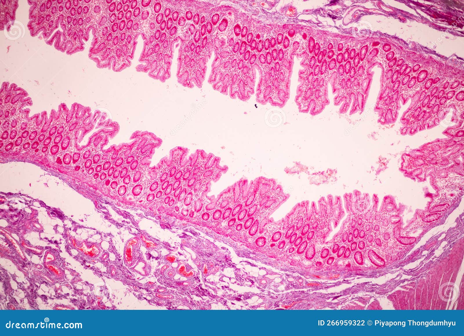Tissue of Small Intestine Duodenum, Large Intestine Human and Stomach ...