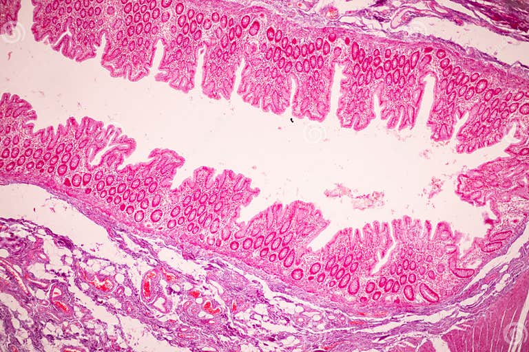 Tissue of Small Intestine Duodenum, Large Intestine Human and Stomach ...