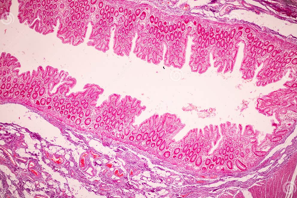 Tissue of Small Intestine Duodenum, Large Intestine Human and Stomach ...