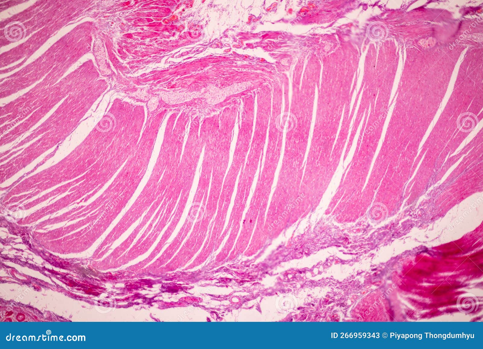 Tissue of Small Intestine Duodenum, Large Intestine Human and Stomach ...
