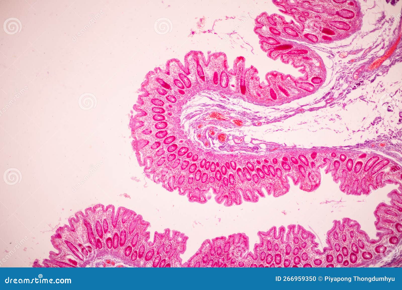 Tissue of Small Intestine Duodenum, Large Intestine Human and Stomach ...