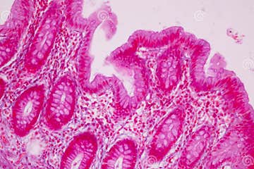 Tissue of Small Intestine Duodenum, Large Intestine Human and Stomach ...