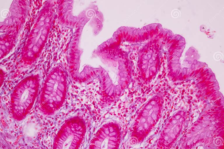 Tissue of Small Intestine Duodenum, Large Intestine Human and Stomach ...