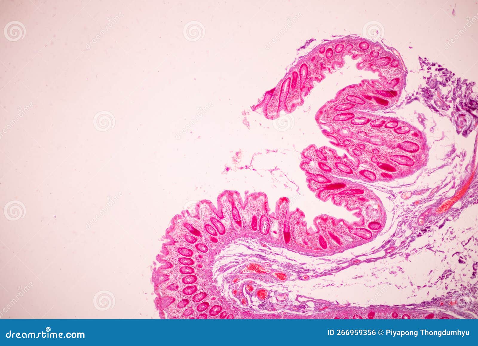 Tissue of Small Intestine Duodenum, Large Intestine Human and Stomach ...