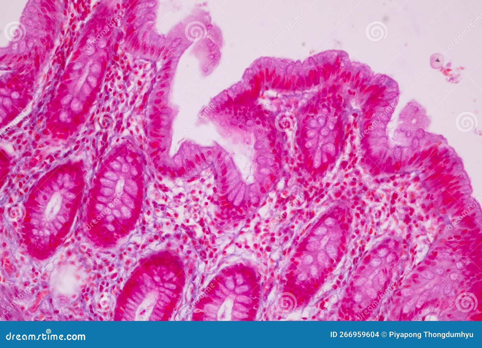 Tissue of Small Intestine Duodenum, Large Intestine Human and Stomach ...