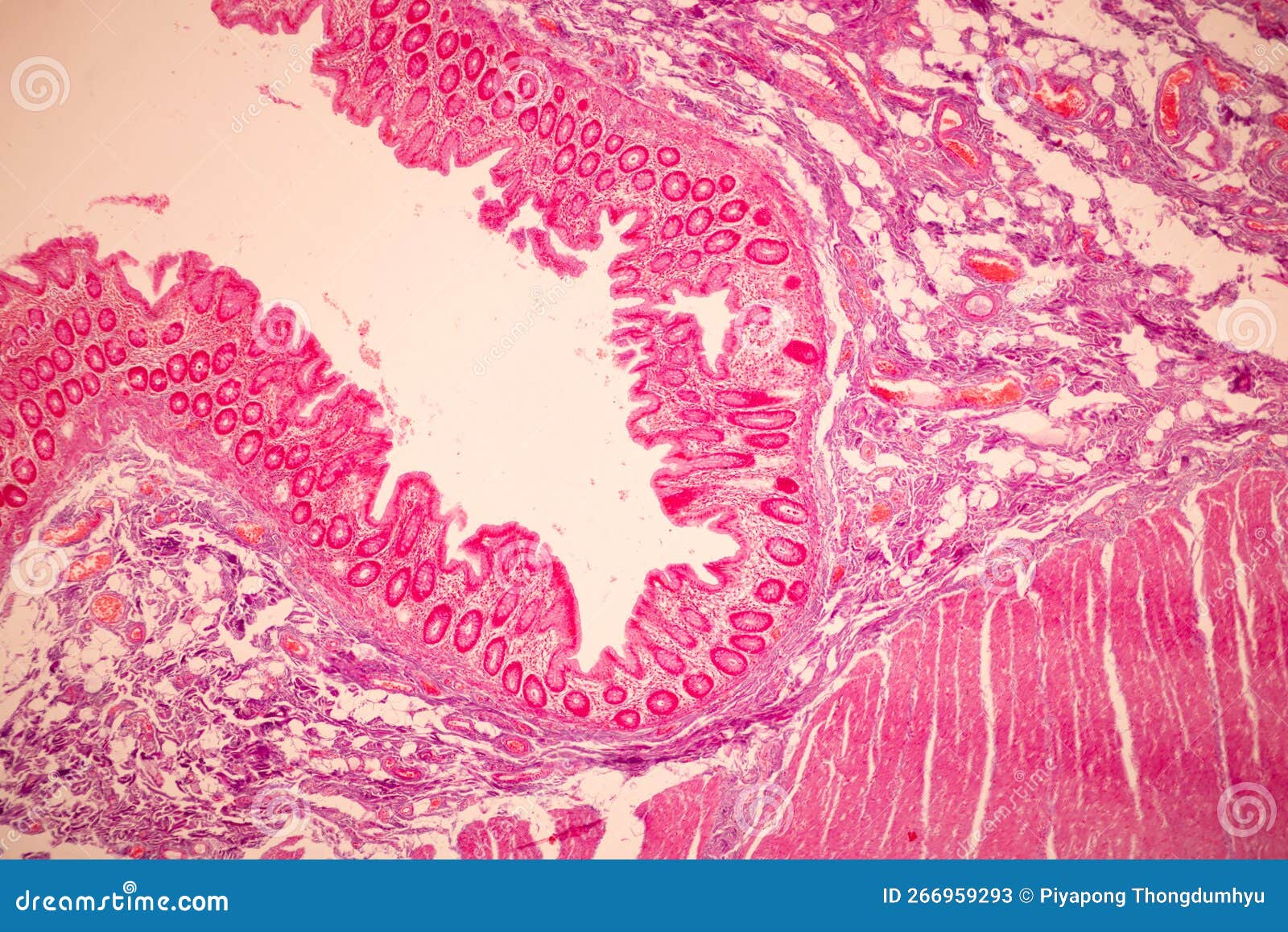 Tissue of Small Intestine Duodenum, Large Intestine Human and Stomach ...