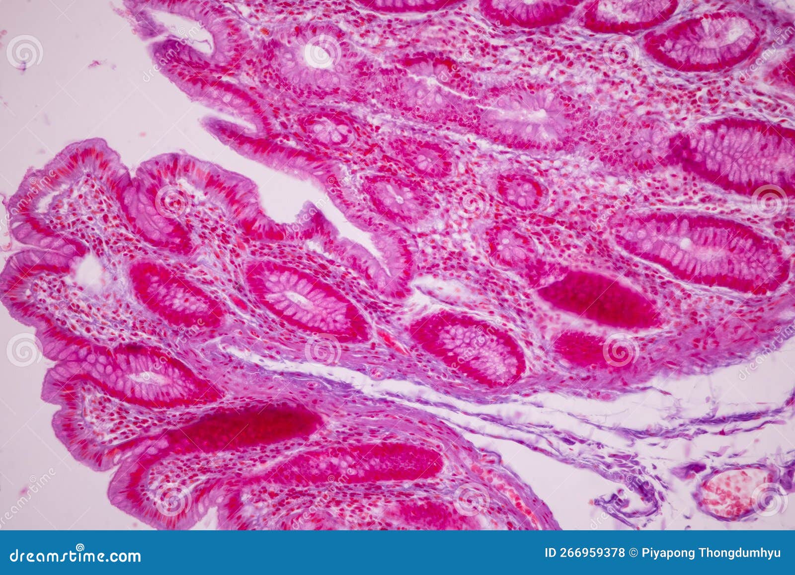 Tissue of Small Intestine Duodenum, Large Intestine Human and Stomach ...