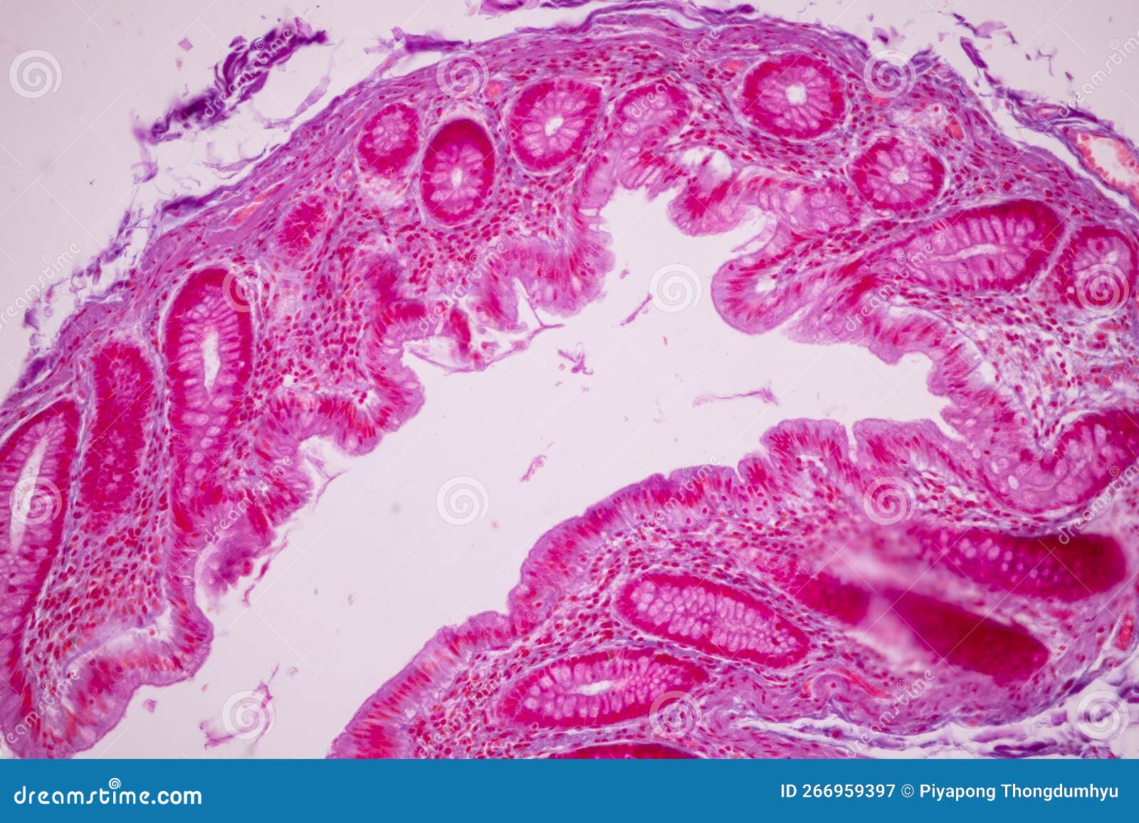 Tissue of Small Intestine Duodenum, Large Intestine Human and Stomach ...
