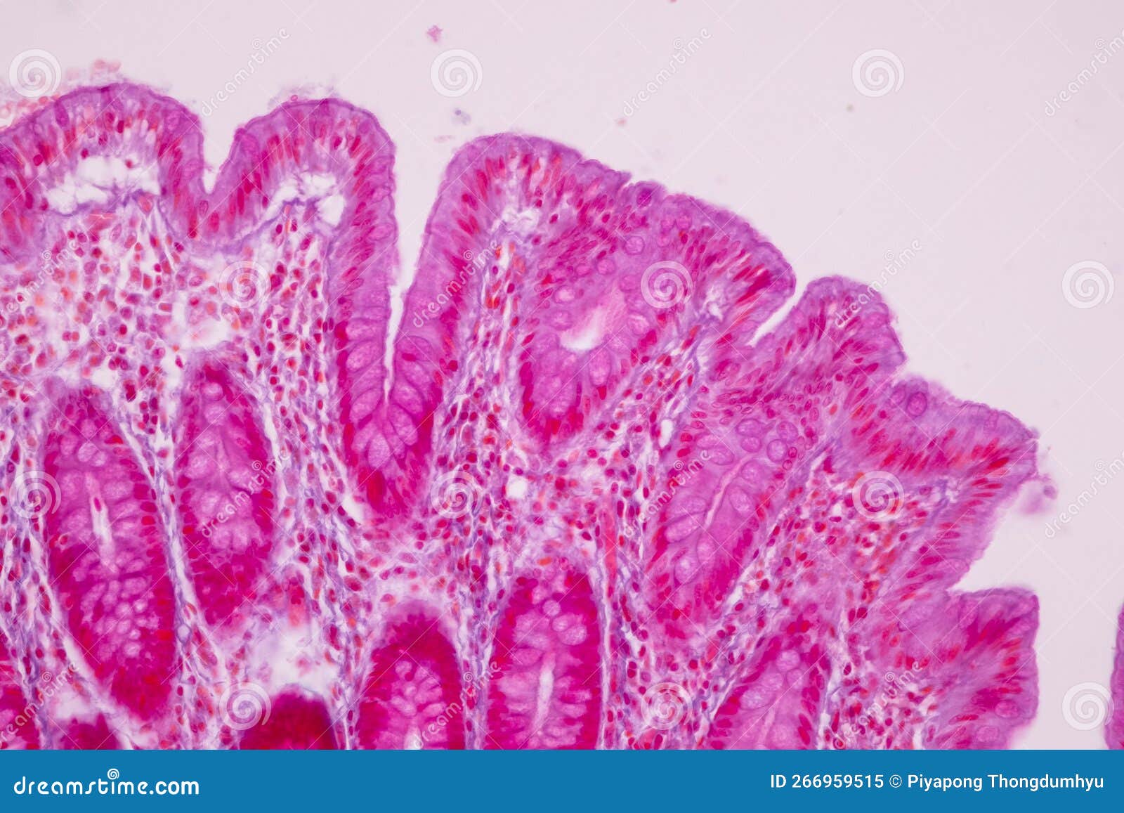 Tissue of Small Intestine Duodenum, Large Intestine Human and Stomach ...