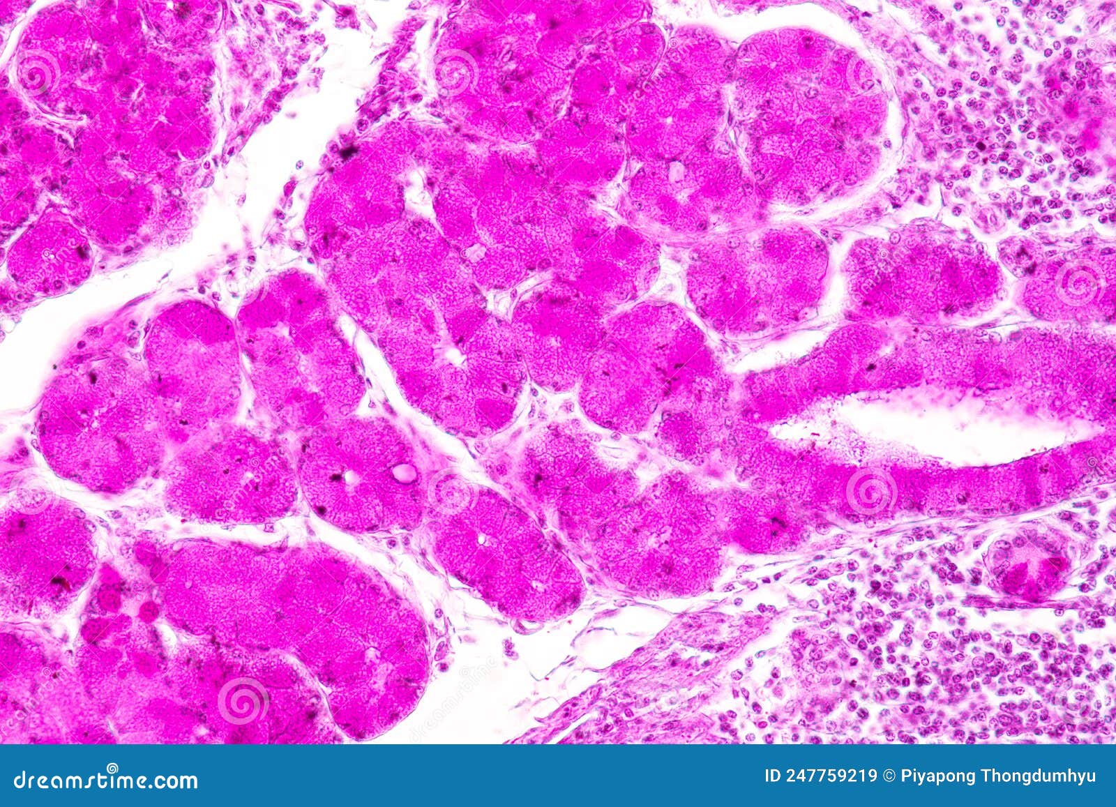 Small Intestine Duodenum and Vermiform Appendix Human Under the ...