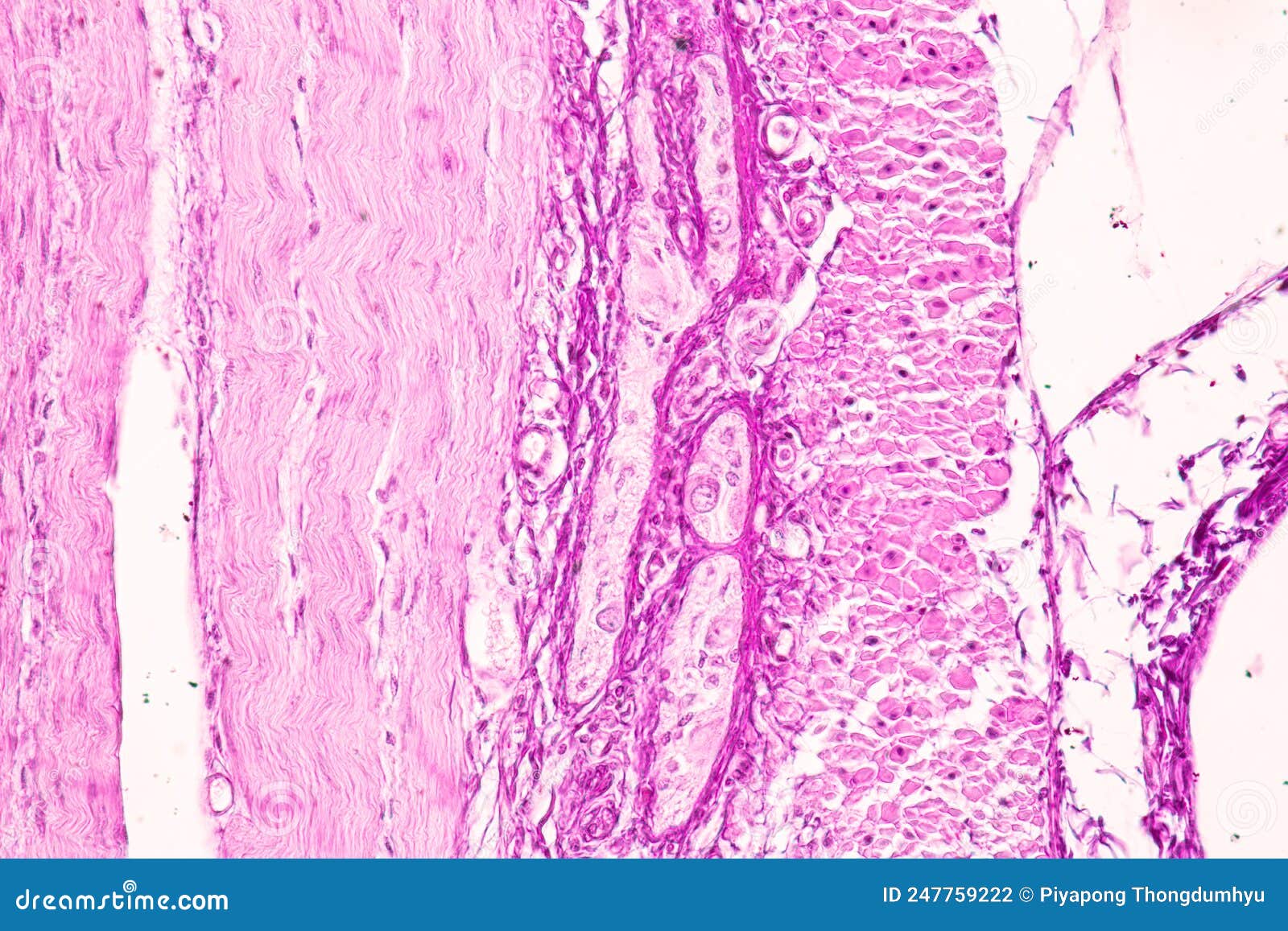 Small Intestine Duodenum and Vermiform Appendix Human Under the ...