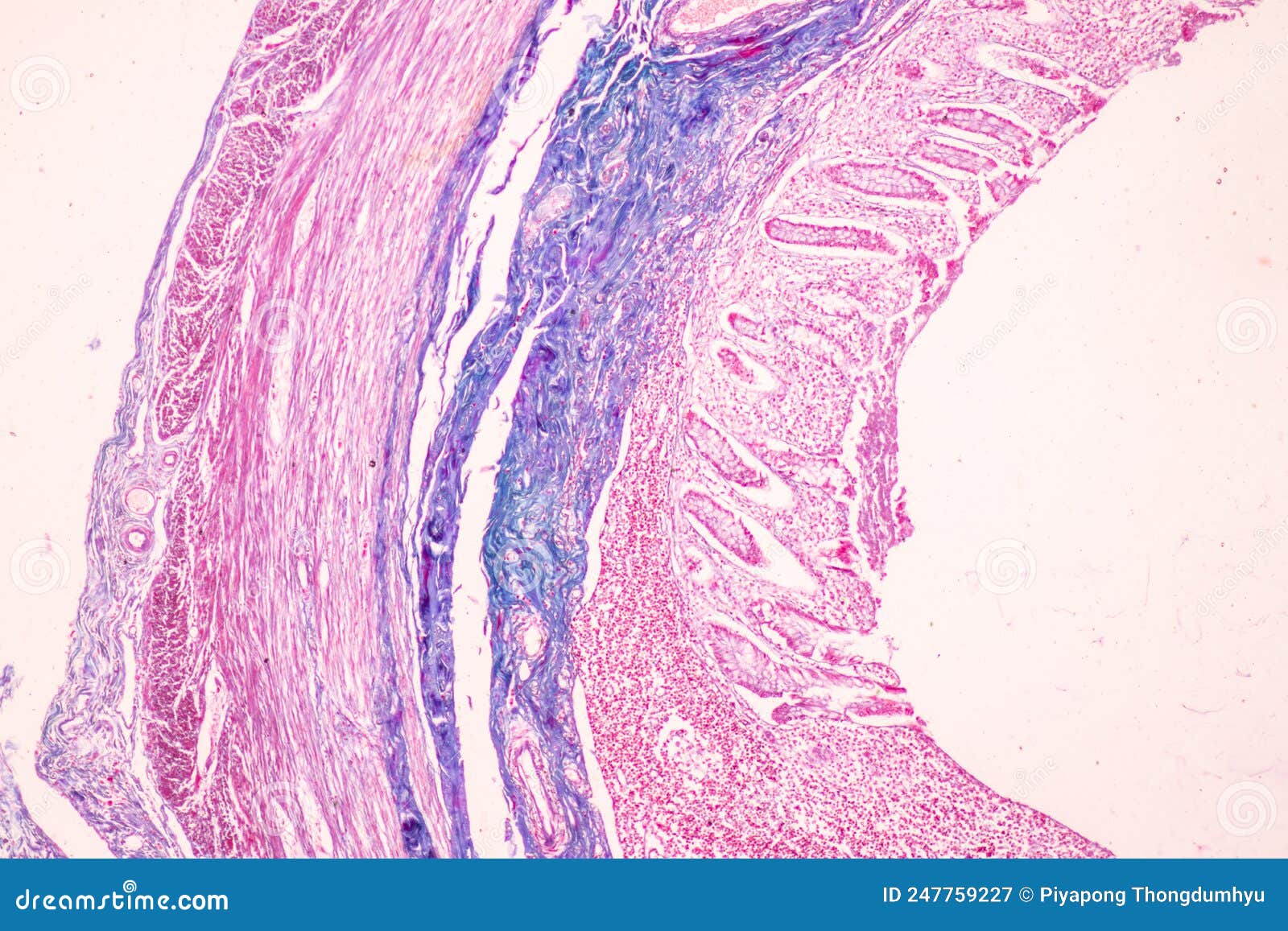 Small Intestine Duodenum and Vermiform Appendix Human Under the ...