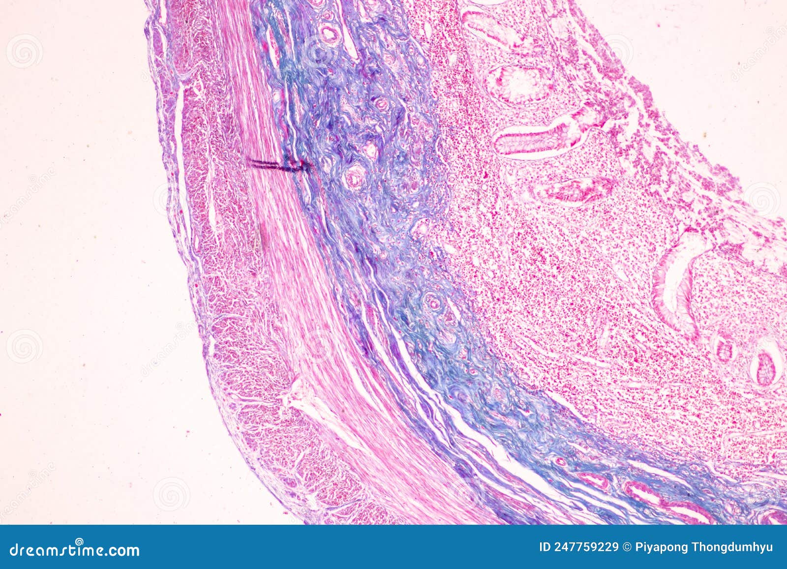 Appendix Histology Diagram