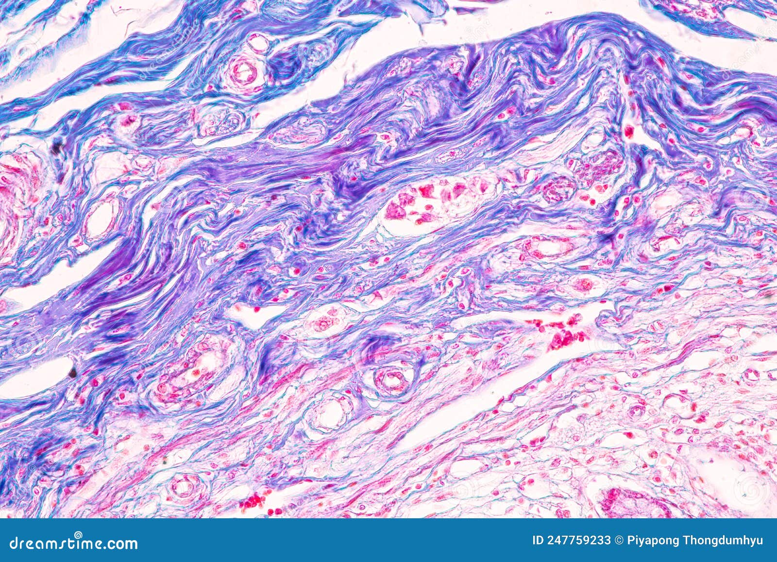 Small Intestine Duodenum and Vermiform Appendix Human Under the ...