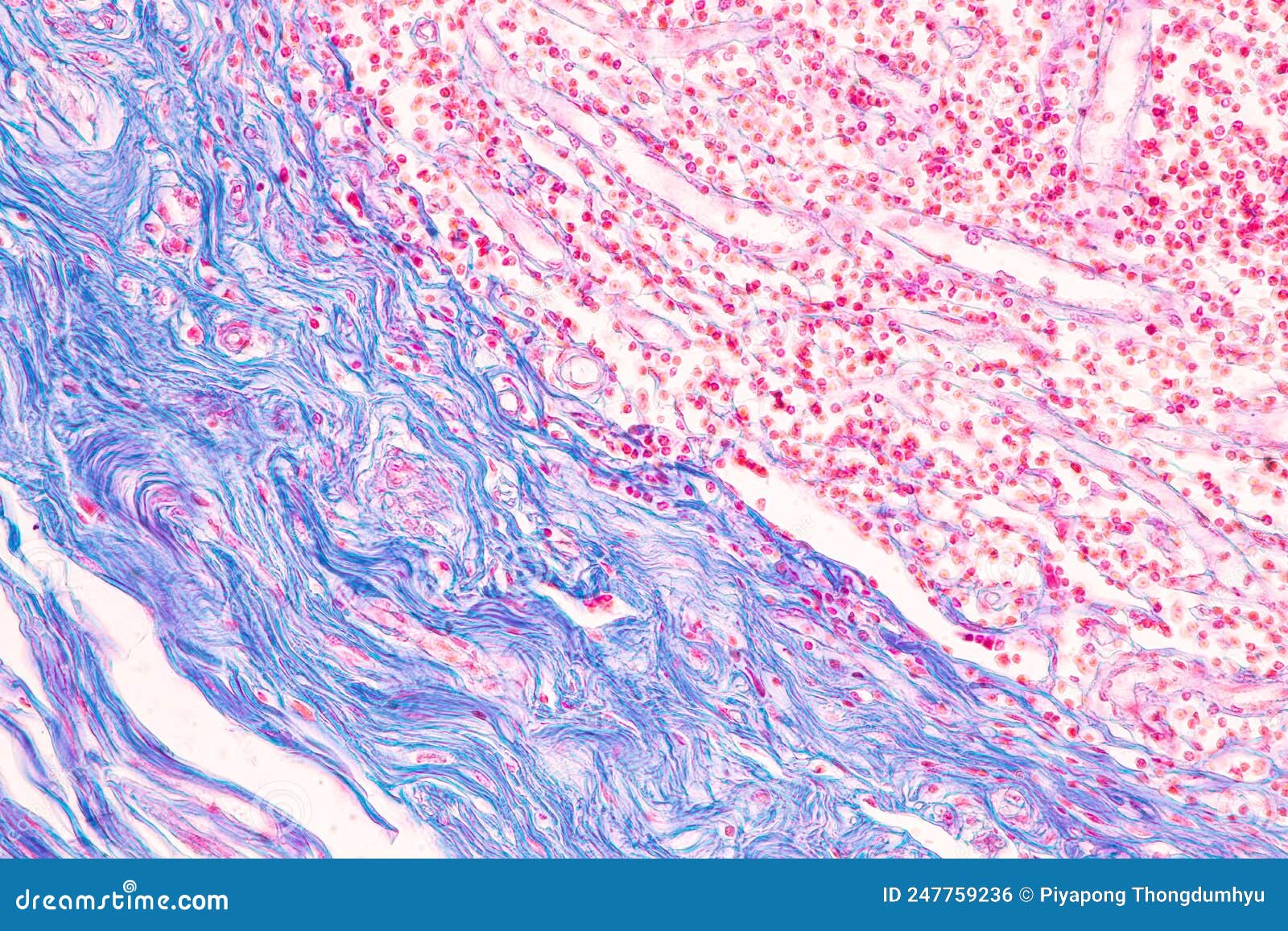 Small Intestine Duodenum and Vermiform Appendix Human Under the ...