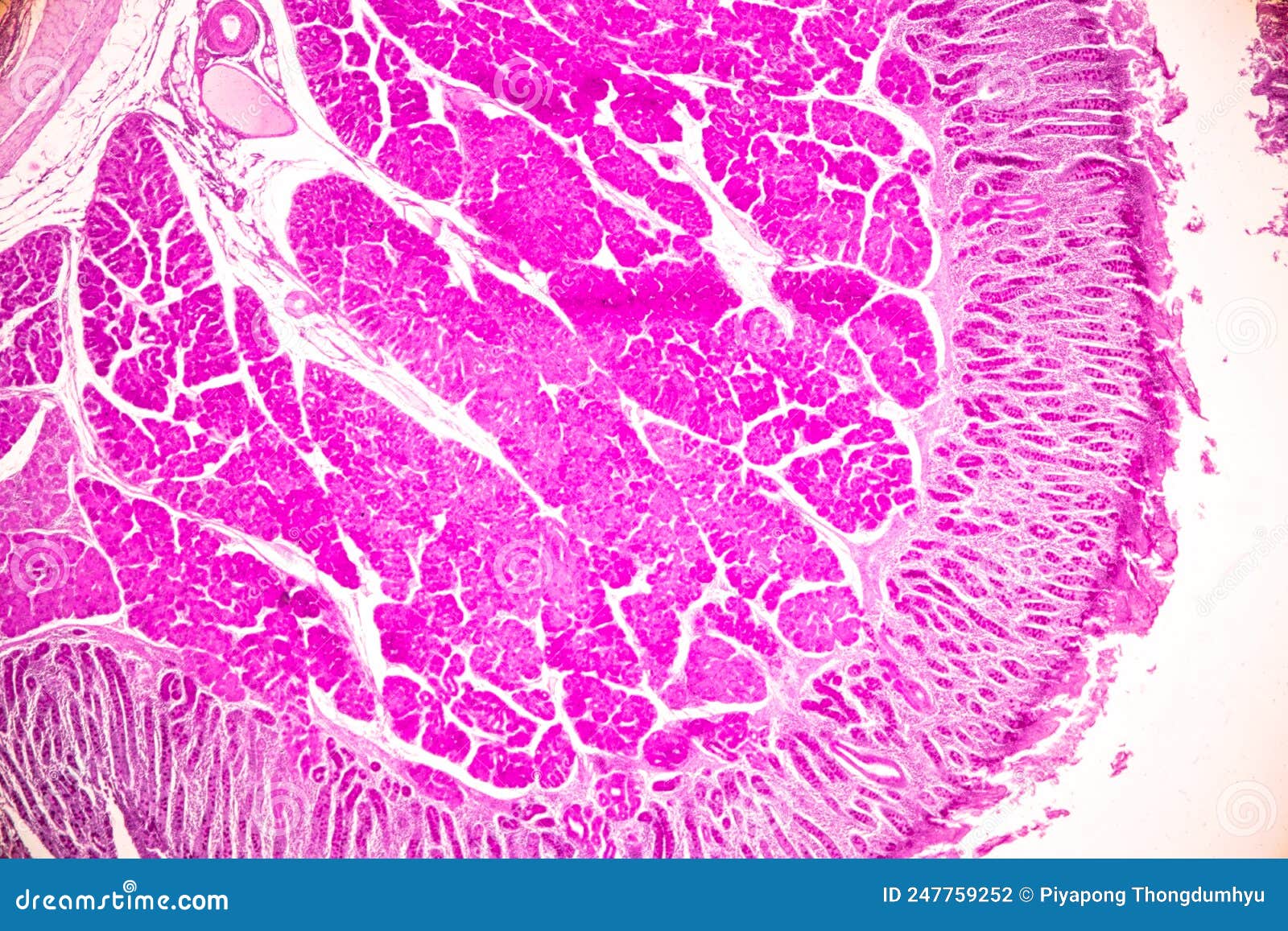 Appendix Histology Labeled