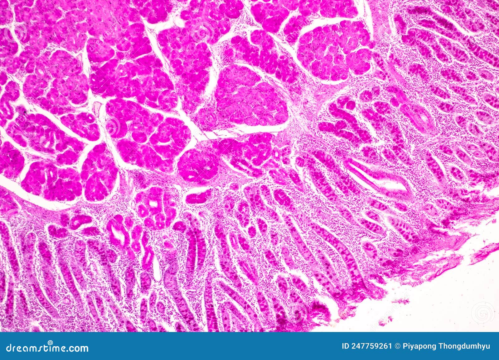Small Intestine Duodenum and Vermiform Appendix Human Under the ...