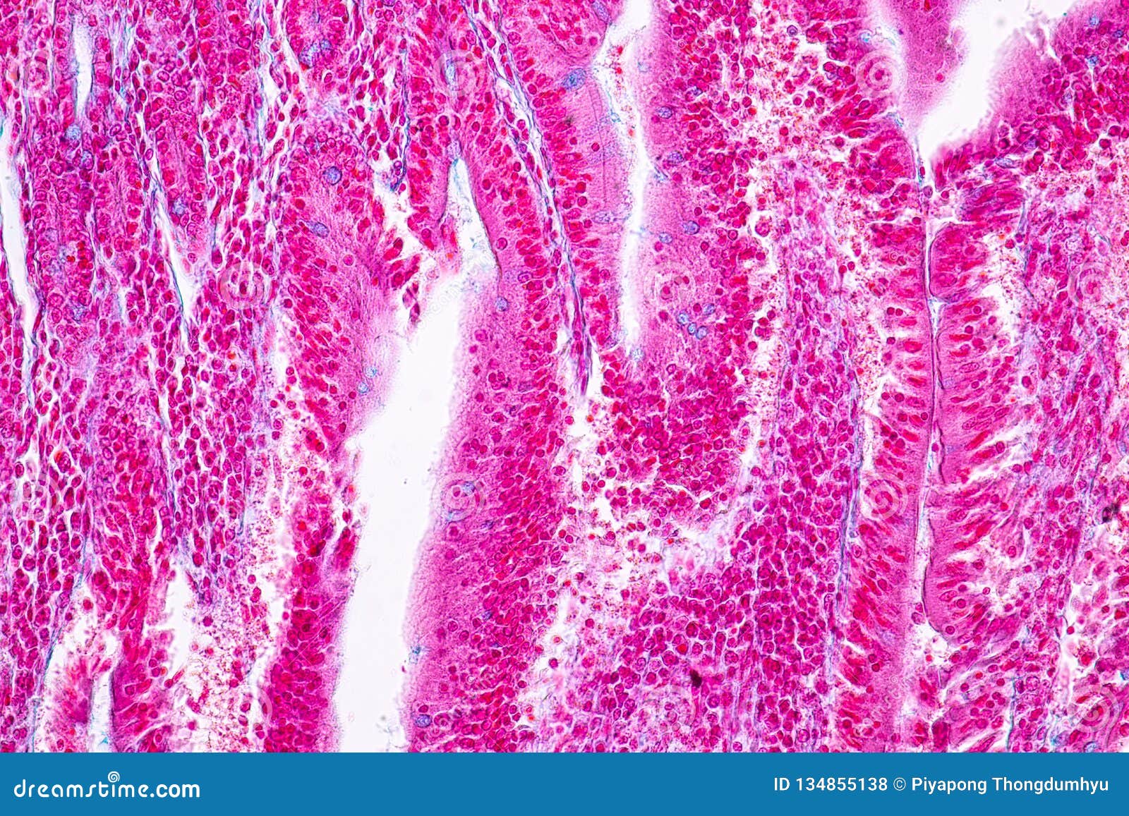 Tissue of Small Intestine or Small Bowel Under the Microscopic. Stock ...