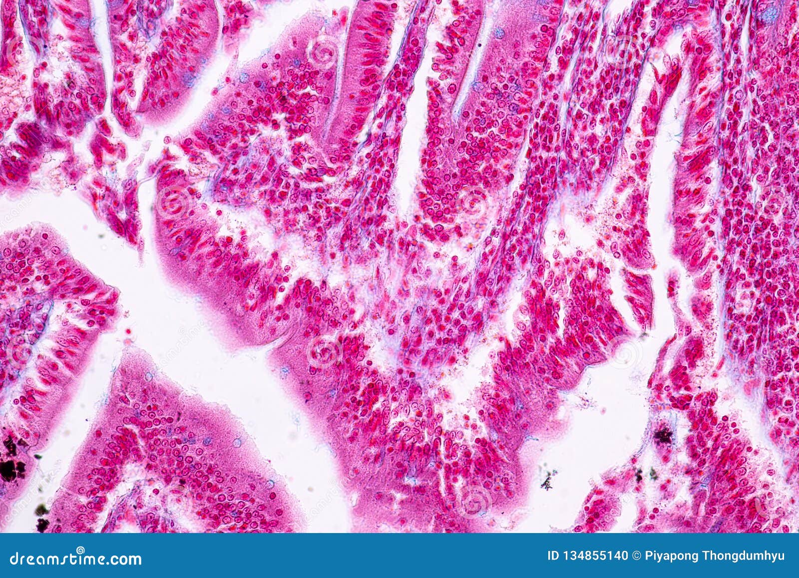 Tissue of Small Intestine or Small Bowel Under the Microscopic. Stock ...