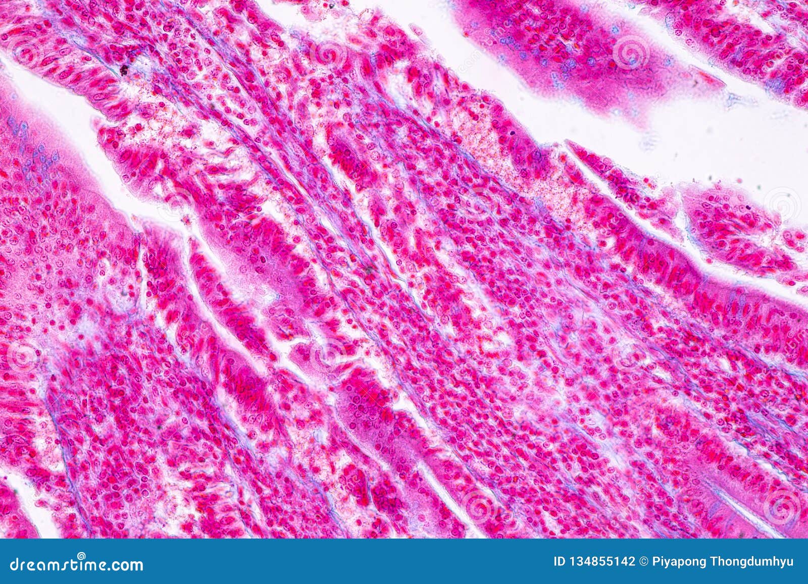 Tissue of Small Intestine or Small Bowel Under the Microscopic. Stock ...