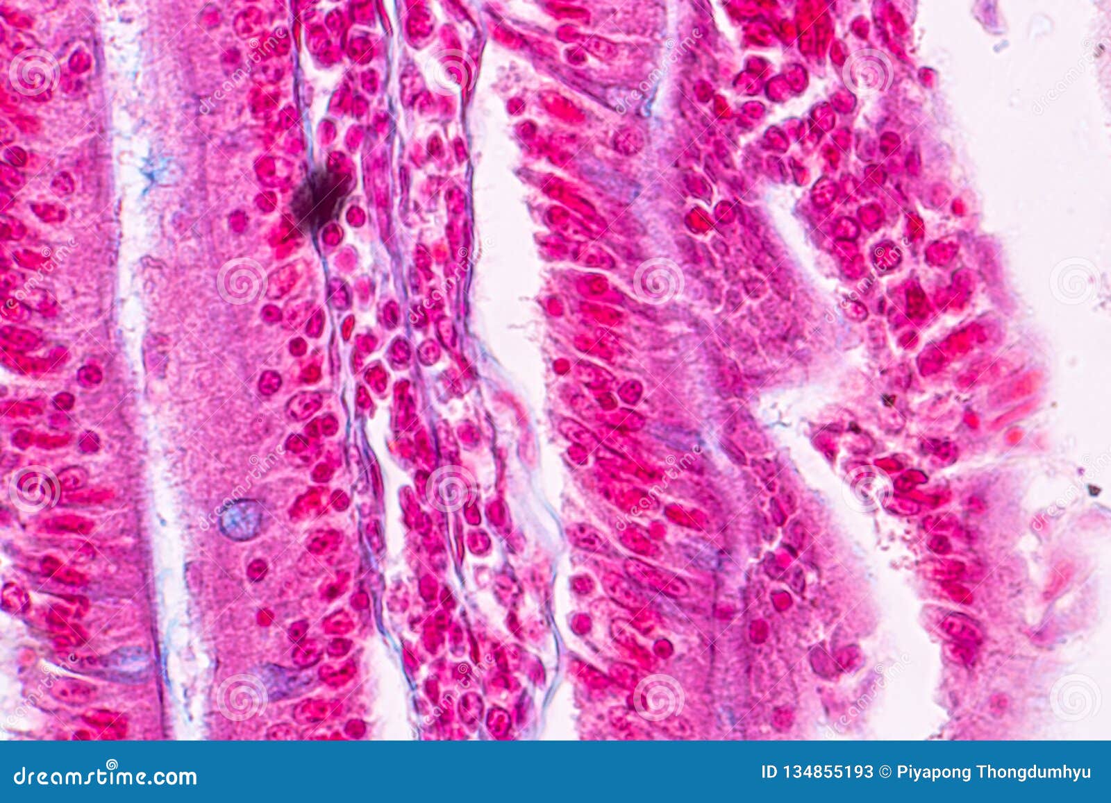 Tissue of Small Intestine or Small Bowel Under the Microscopic. Stock ...