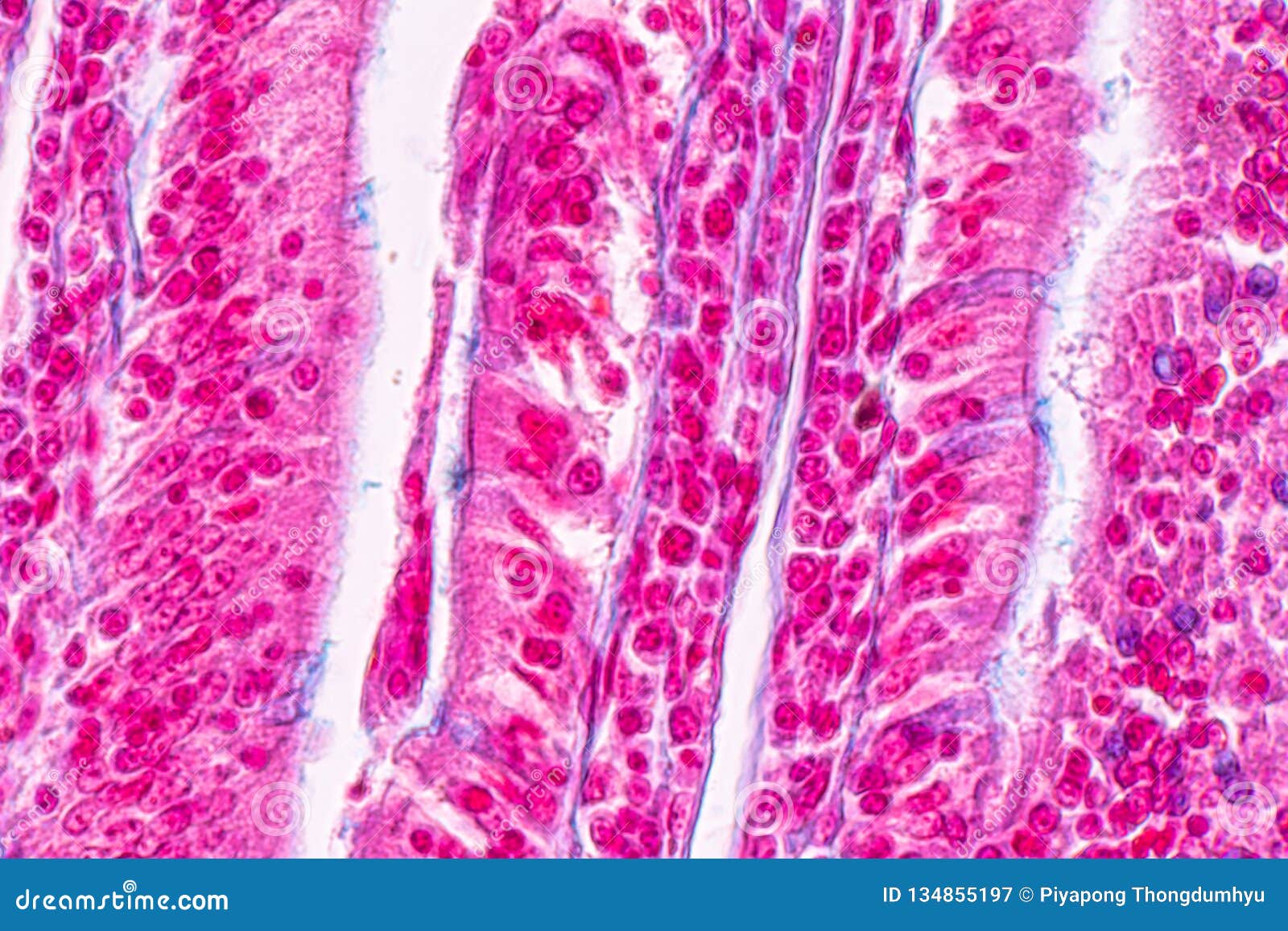 Tissue of Small Intestine or Small Bowel Under the Microscopic. Stock ...
