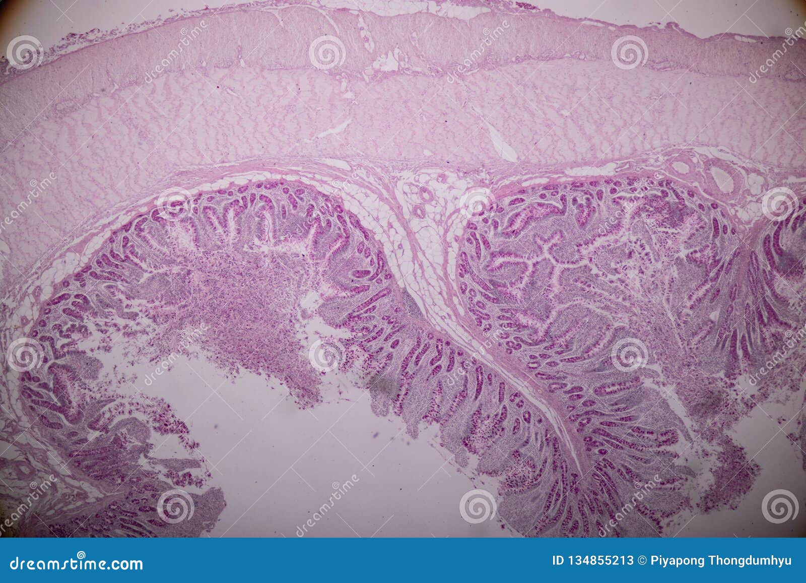 Tissue of Small Intestine or Small Bowel Under the Microscopic. Stock ...