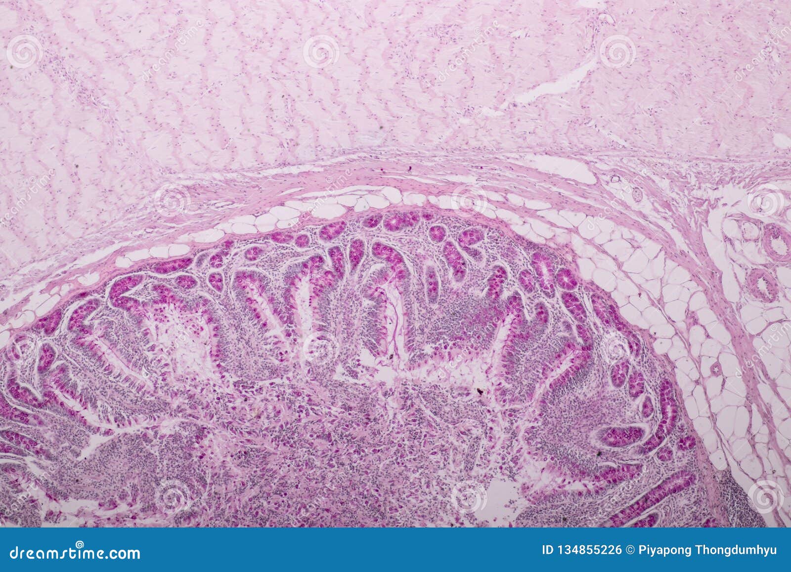 Tissue of Small Intestine or Small Bowel Under the Microscopic. Stock ...