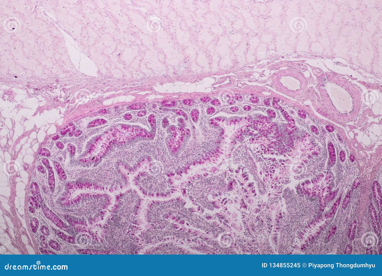 Tissue of Small Intestine or Small Bowel Under the Microscopic. Stock ...