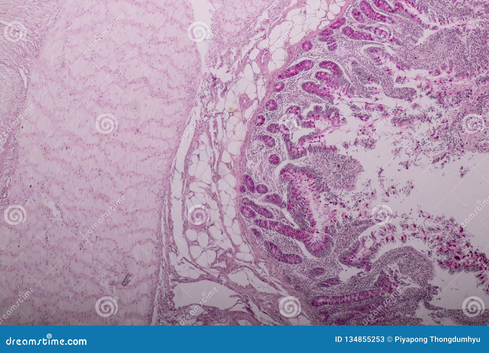 Tissue of Small Intestine or Small Bowel Under the Microscopic. Stock ...