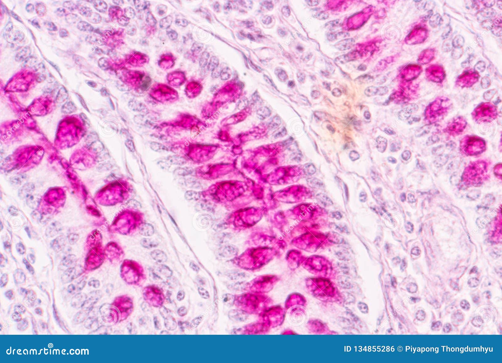 Tissue of Small Intestine or Small Bowel Under the Microscopic. Stock ...