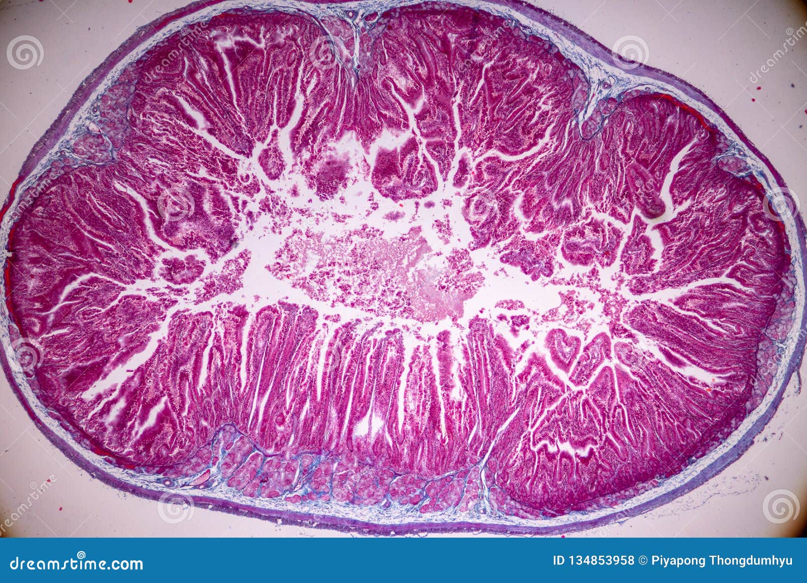 Tissue of Small Intestine or Small Bowel Under the Microscopic. Stock ...