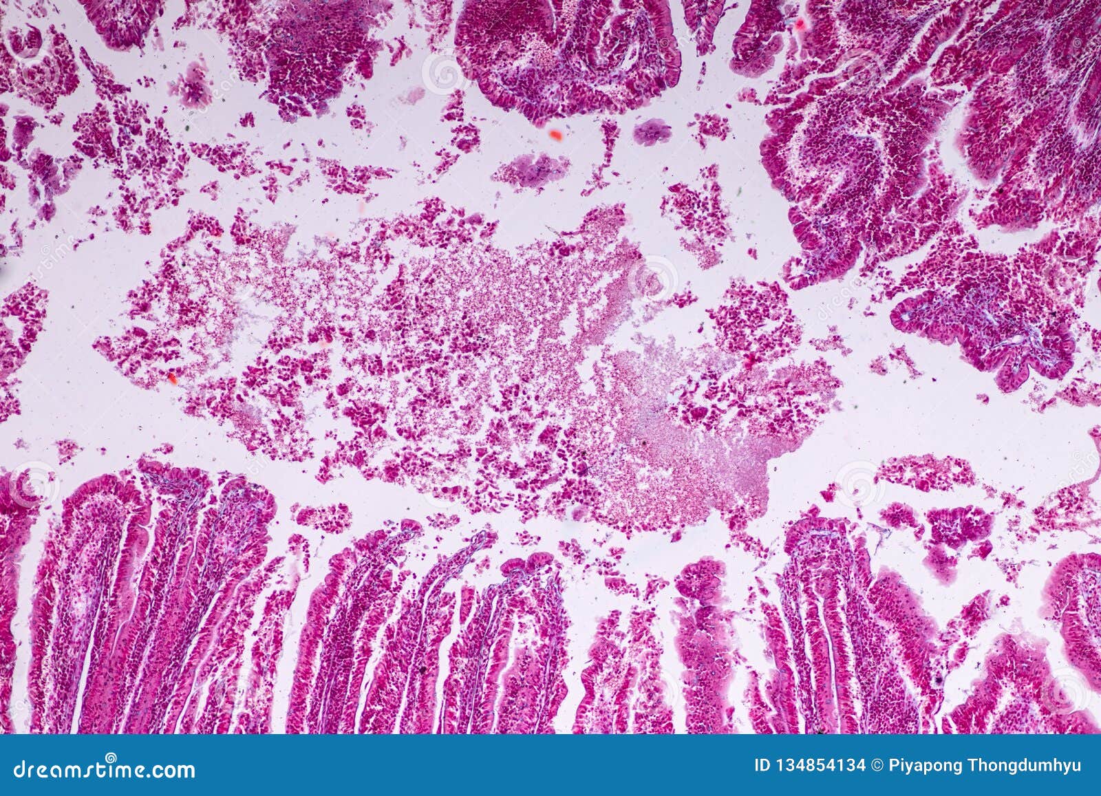 Tissue of Small Intestine or Small Bowel Under the Microscopic. Stock ...