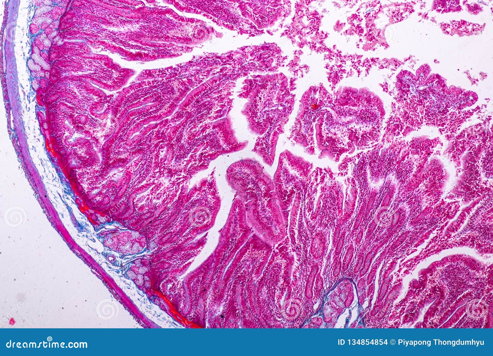 Tissue of Small Intestine or Small Bowel Under the Microscopic. Stock ...