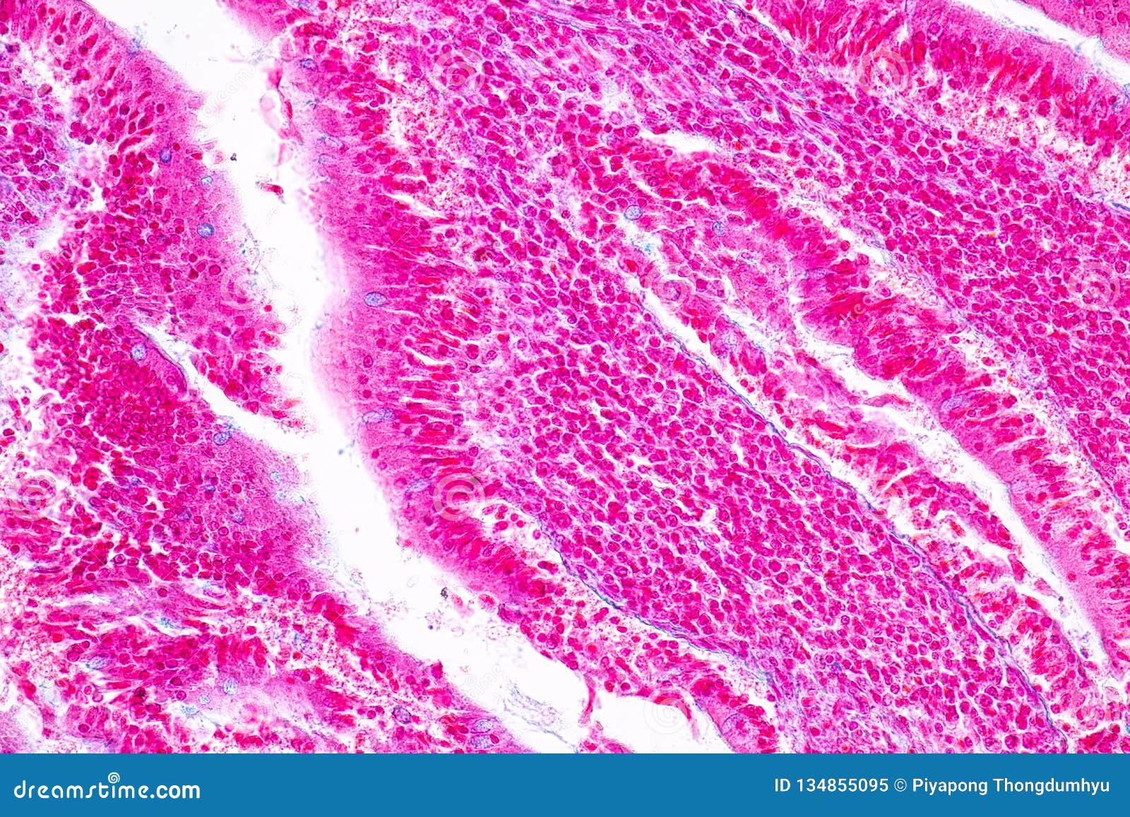 Tissue of Small Intestine or Small Bowel Under the Microscopic. Stock ...