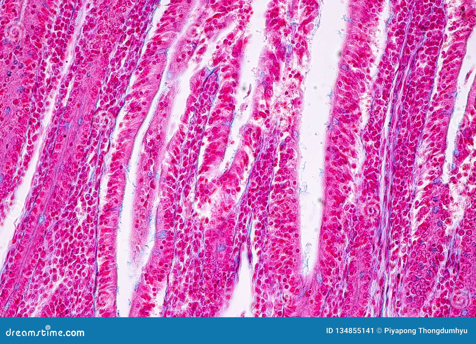 Tissue of Small Intestine or Small Bowel Under the Microscopic. Stock ...