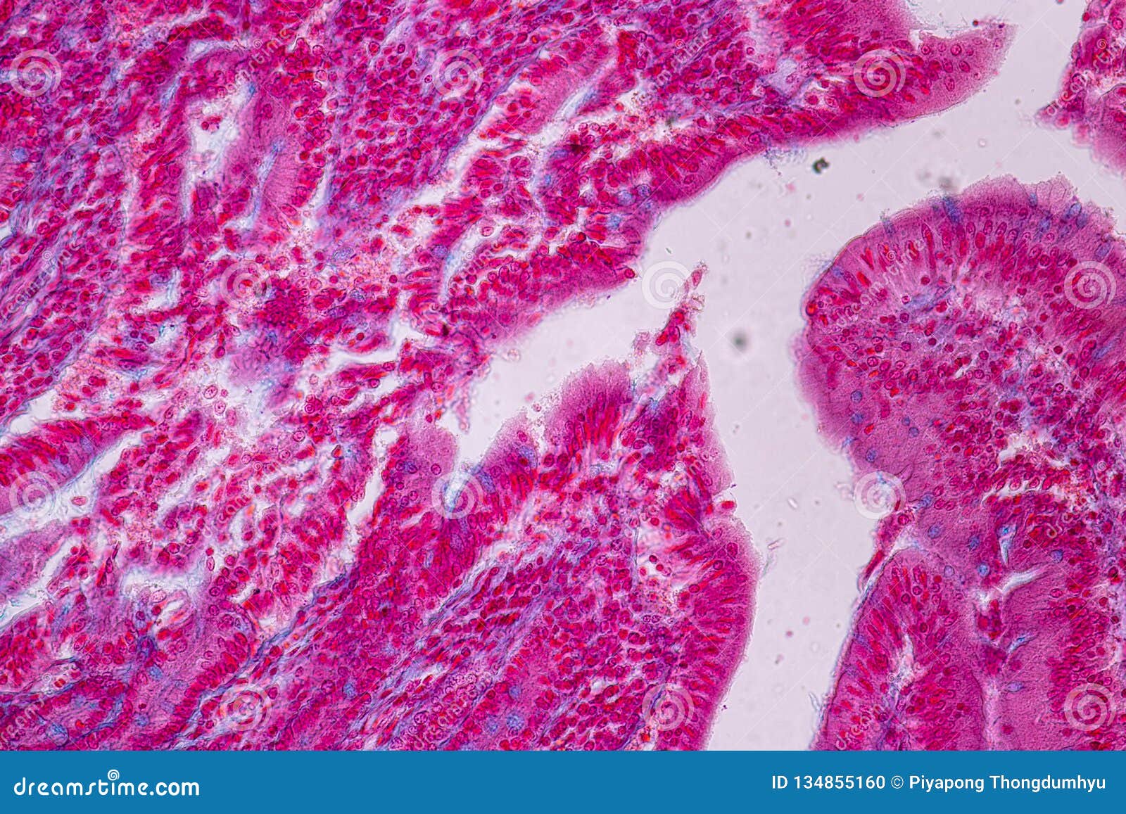 Tissue of Small Intestine or Small Bowel Under the Microscopic. Stock ...