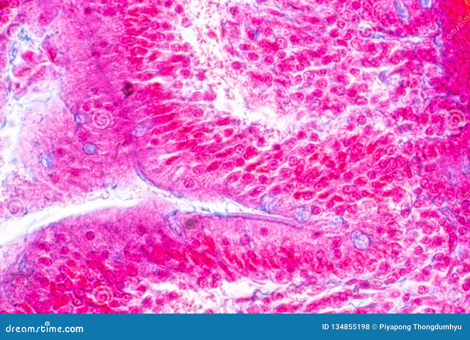Tissue of Small Intestine or Small Bowel Under the Microscopic. Stock ...