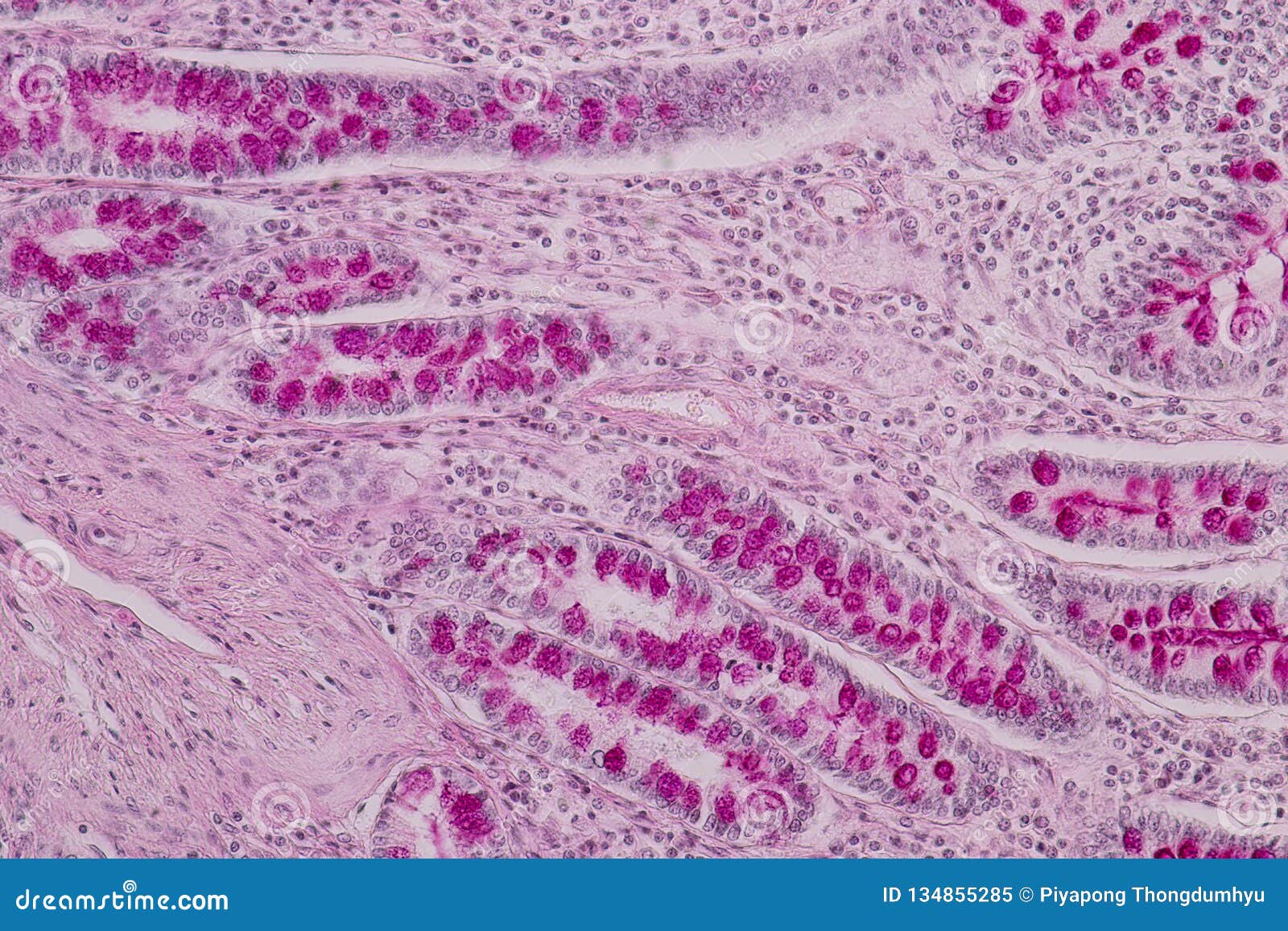 Tissue of Small Intestine or Small Bowel Under the Microscopic. Stock ...