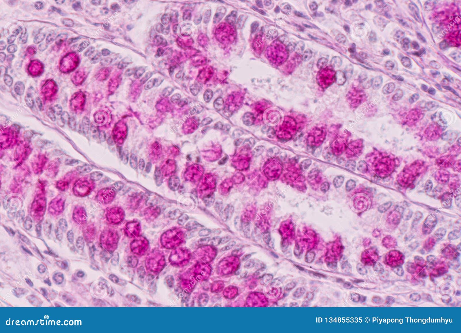 Tissue of Small Intestine or Small Bowel Under the Microscopic. Stock ...