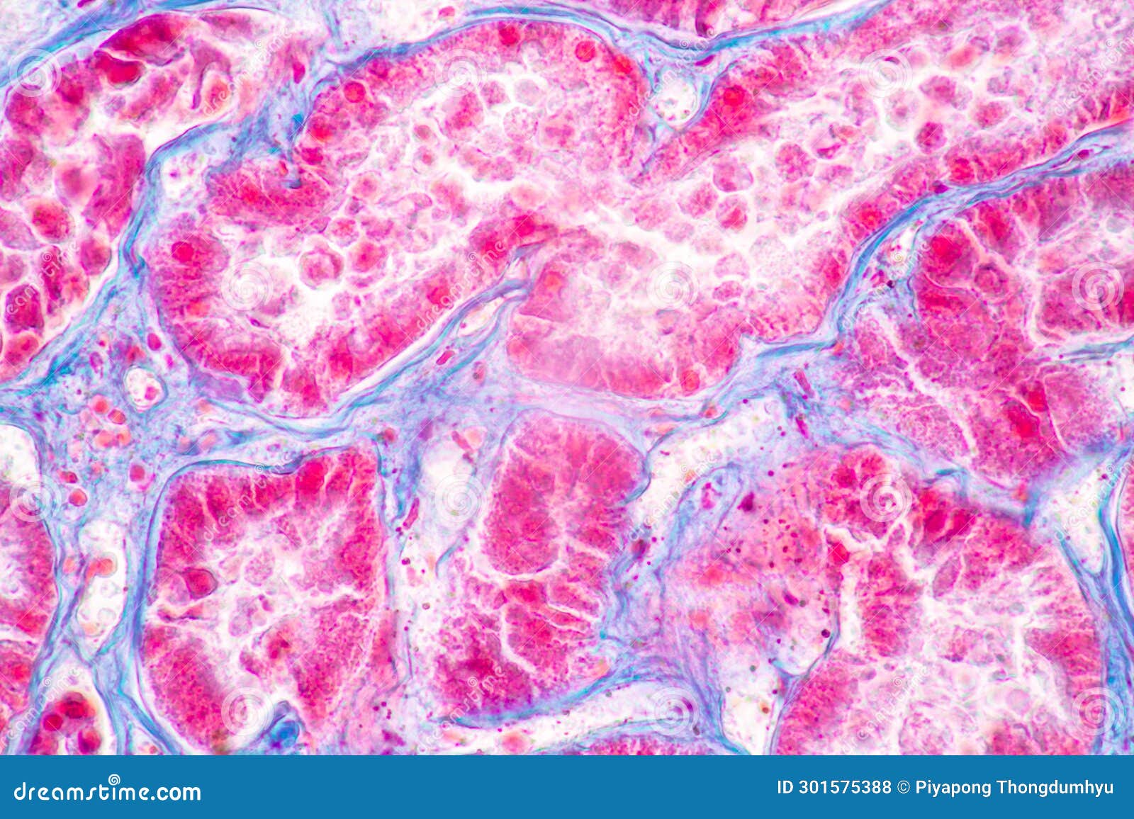 Tissue of Spleen Human, Liver Human and Kidney Human Under the ...