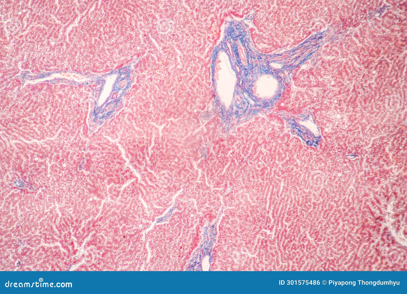Tissue of Spleen Human, Liver Human and Kidney Human Under the ...