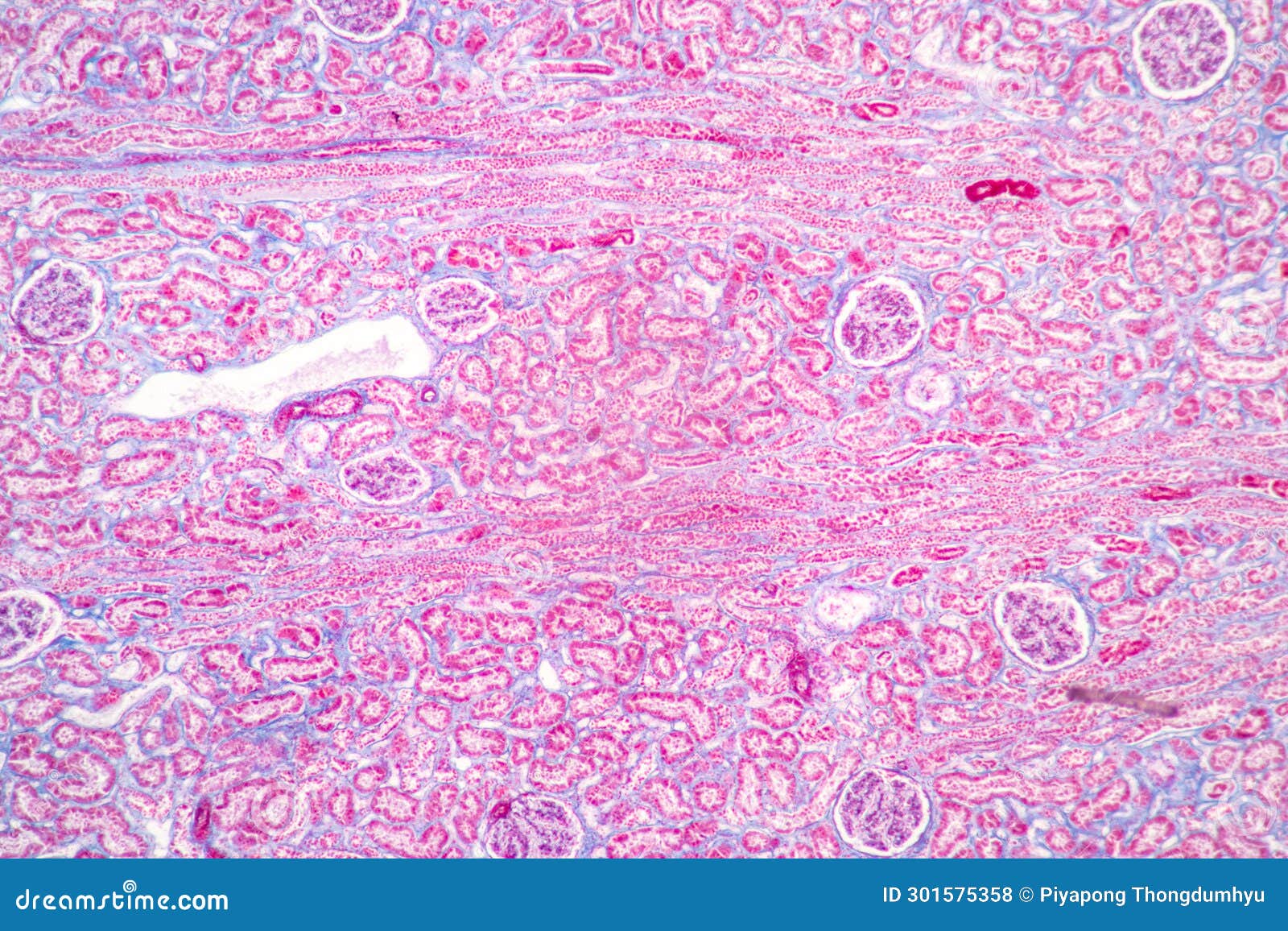 Tissue Of Spleen Human, Liver Human And Kidney Human Under The ...