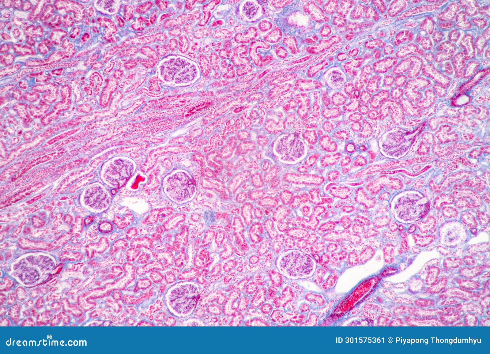Tissue of Spleen Human, Liver Human and Kidney Human Under the ...